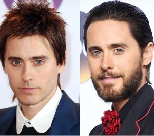21 Photos Of Celebrities With & Without Beard — Beard Style