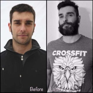 45 Amazing Beard Before and After Transformations