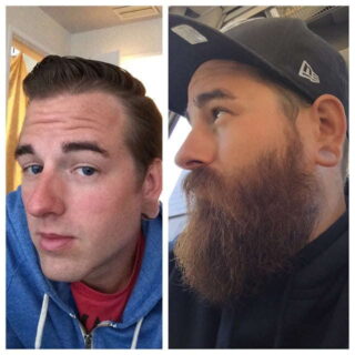 45 Amazing Beard Before and After Transformations