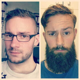 45 Amazing Beard Before and After Transformation Photos