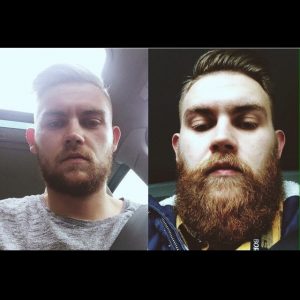 45 Amazing Beard Before and After Transformation Photos