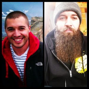45 Amazing Beard Before and After Transformation Photos