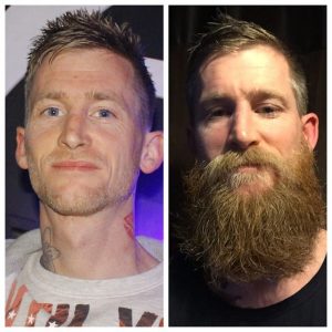 45 Amazing Beard Before and After Transformation Photos