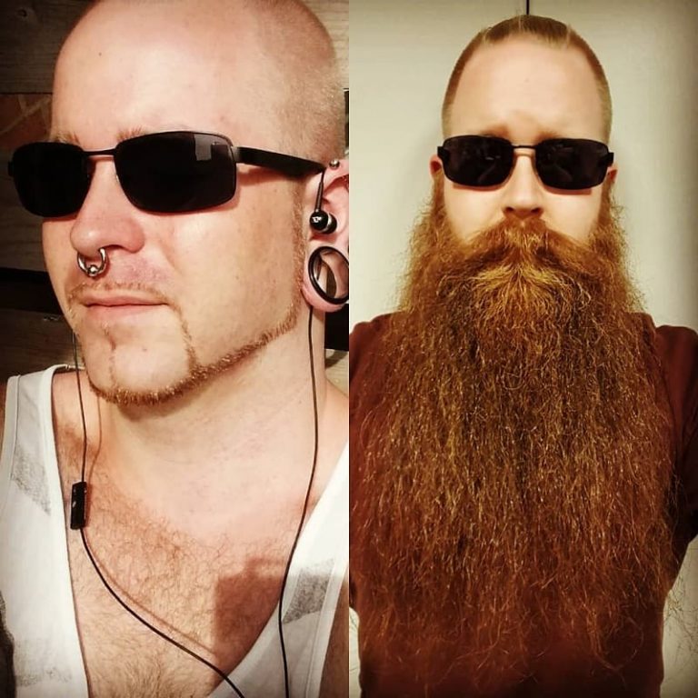 45 Amazing Beard Before and After Transformations