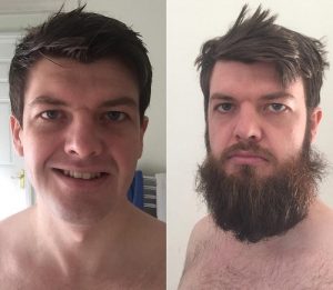45 Amazing Beard Before and After Transformations